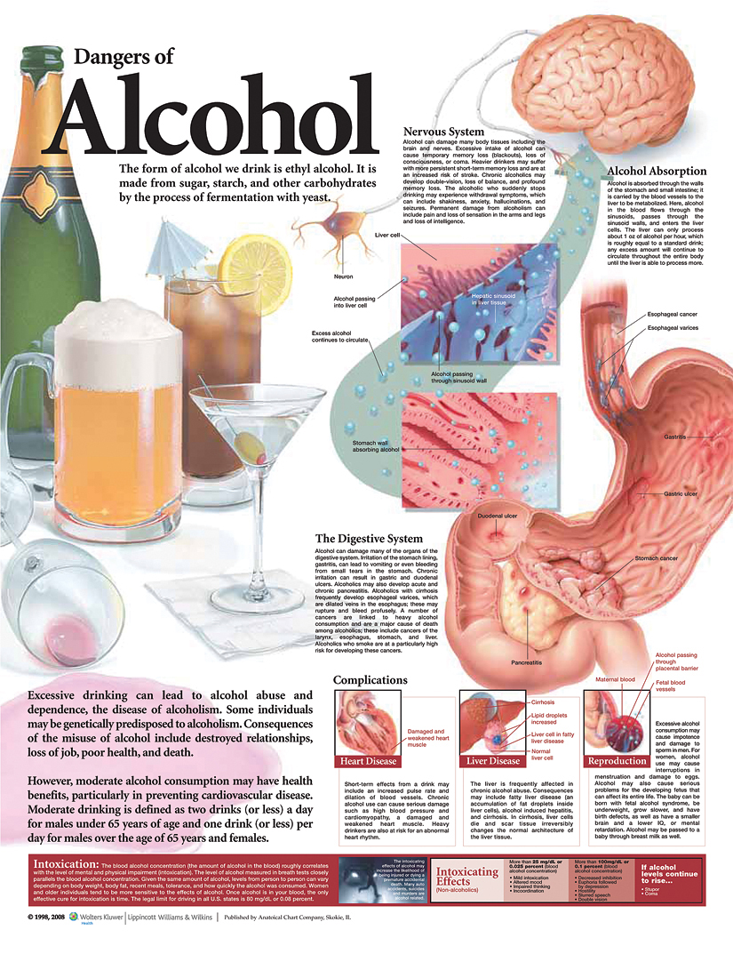 Dangers of Alcohol Chart | Flinn Scientific