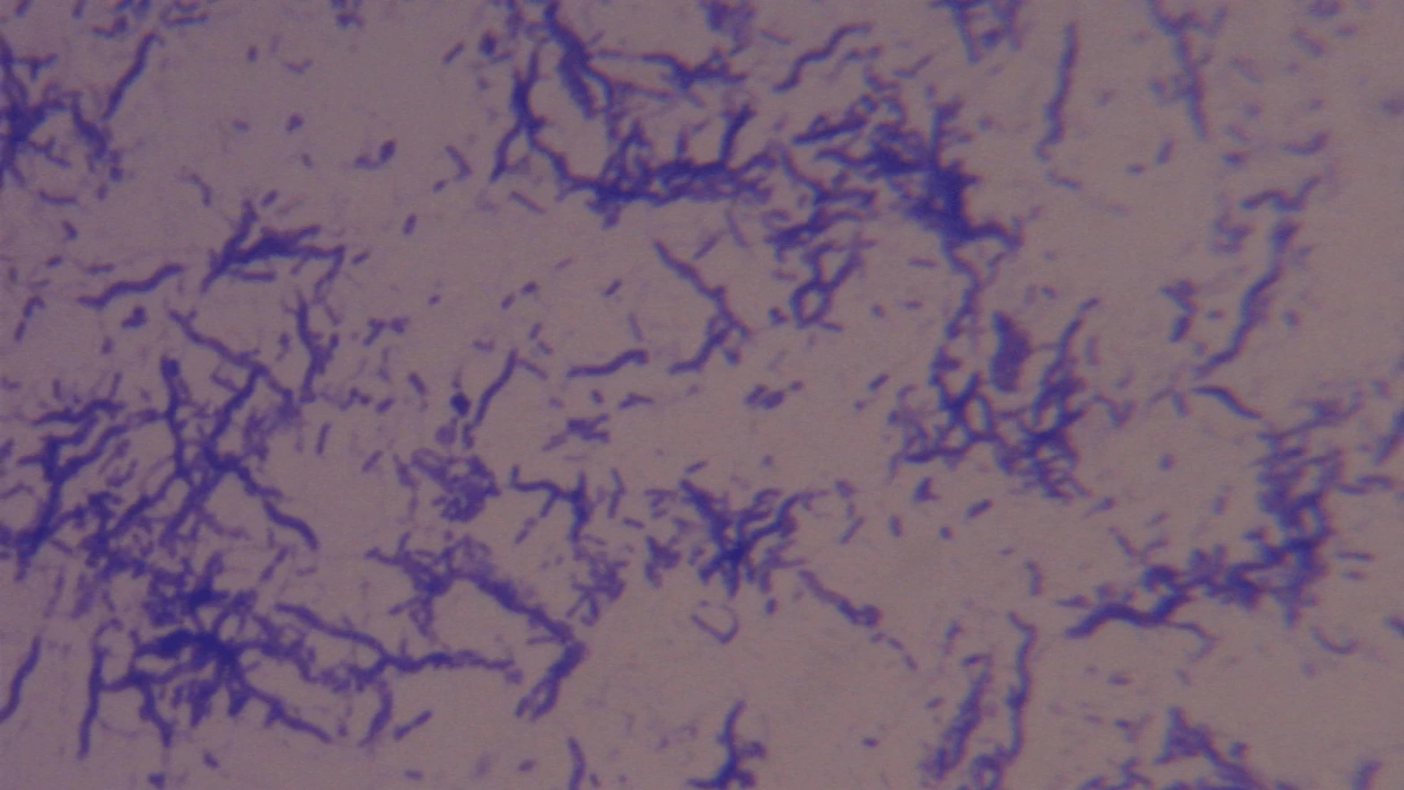 spirillum under microscope