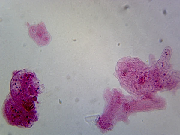 amoeba proteus under a microscope