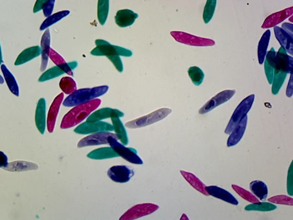 paramecium under microscope