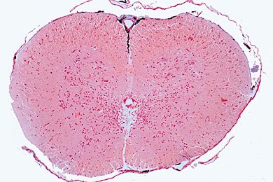 Slide, Frog—Spinal Cord, c.s. | Flinn Scientific