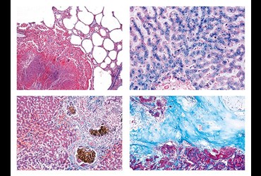 Human Pathology Slide Sets