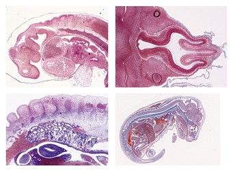 Embryology Slide Sets